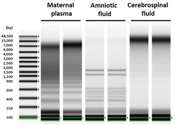 Cambridge Bioscience: Cell-free DNA purification from biofluids: Quick ...