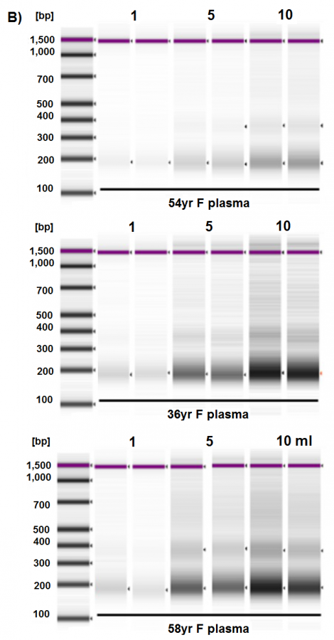 Simple cell-free DNA purification - Quick-cfDNA™ Serum & Plasma Kit